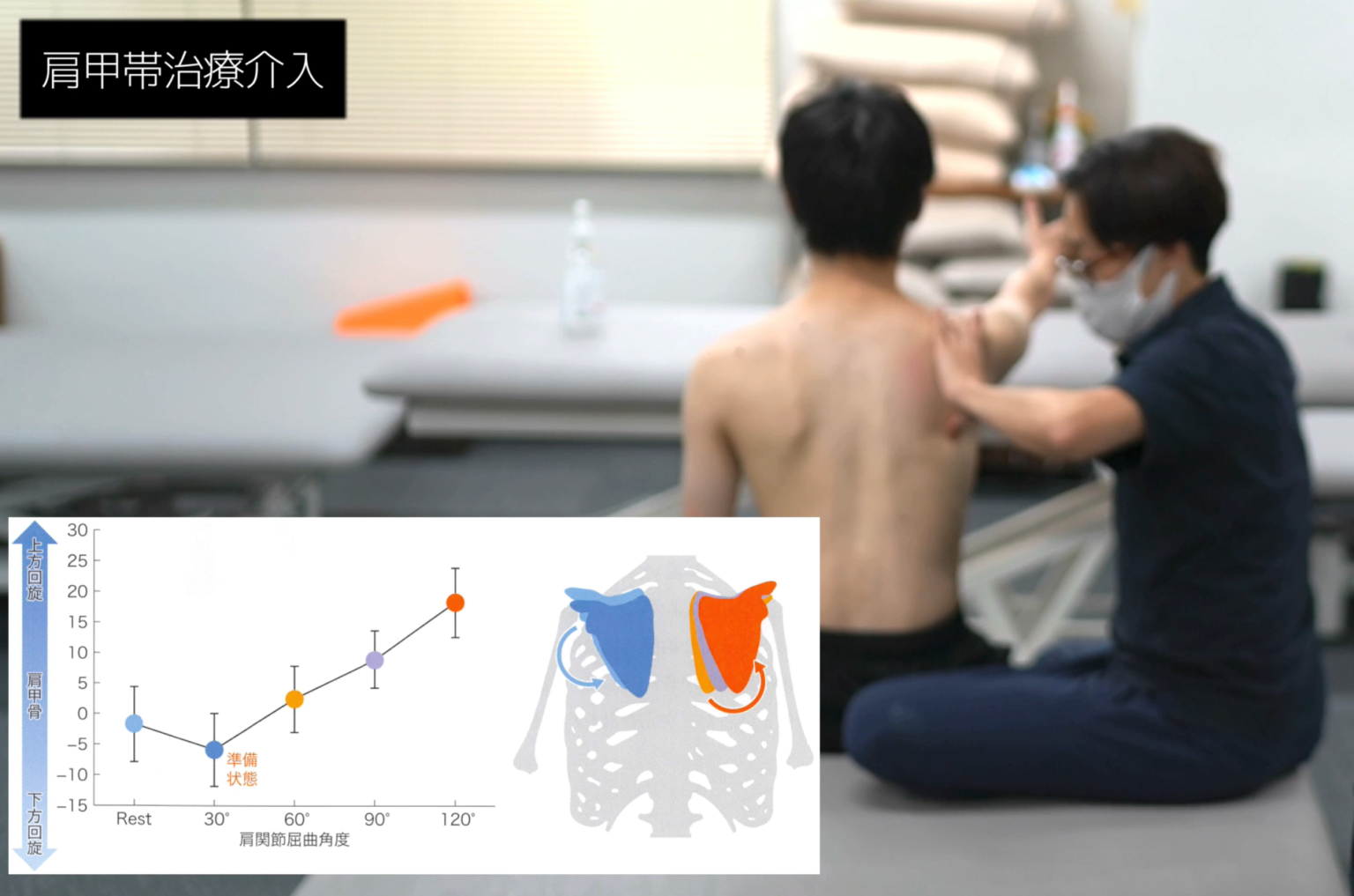 【2024年版】上腕骨骨折への保存・手術 / リハビリテーション / 自主トレーニングまで解説！ – STROKE LAB 東京/大阪 自費 ...