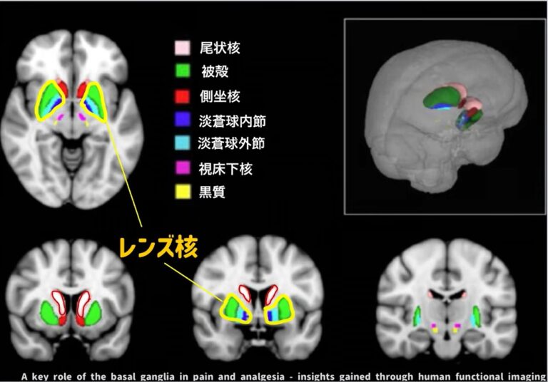 【2025年版】淡蒼球の解剖と役割、リハビリ戦略：被殻における運動学習を解説！ – STROKE LAB 東京/大阪 自費リハビリ | 脳卒中/神経系